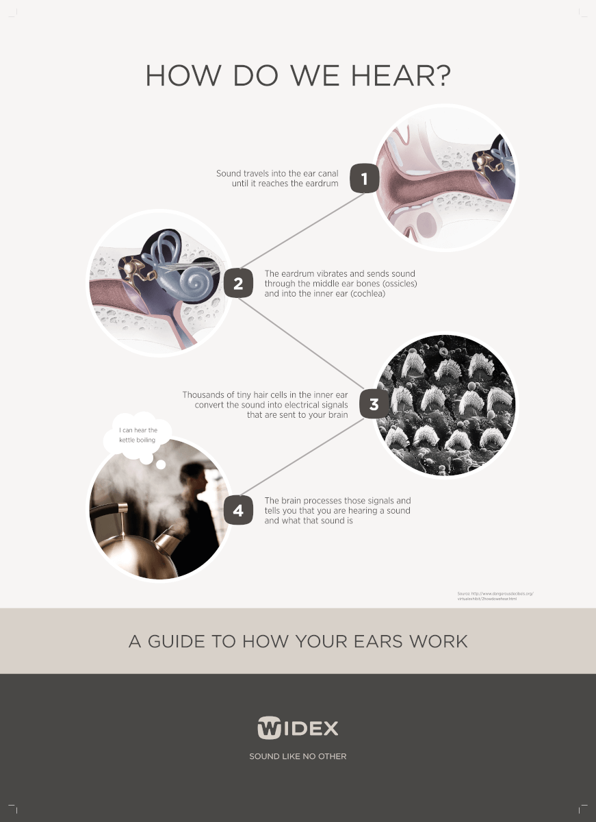 Infographics access - Free hearing posters and infographics | Widex Pro