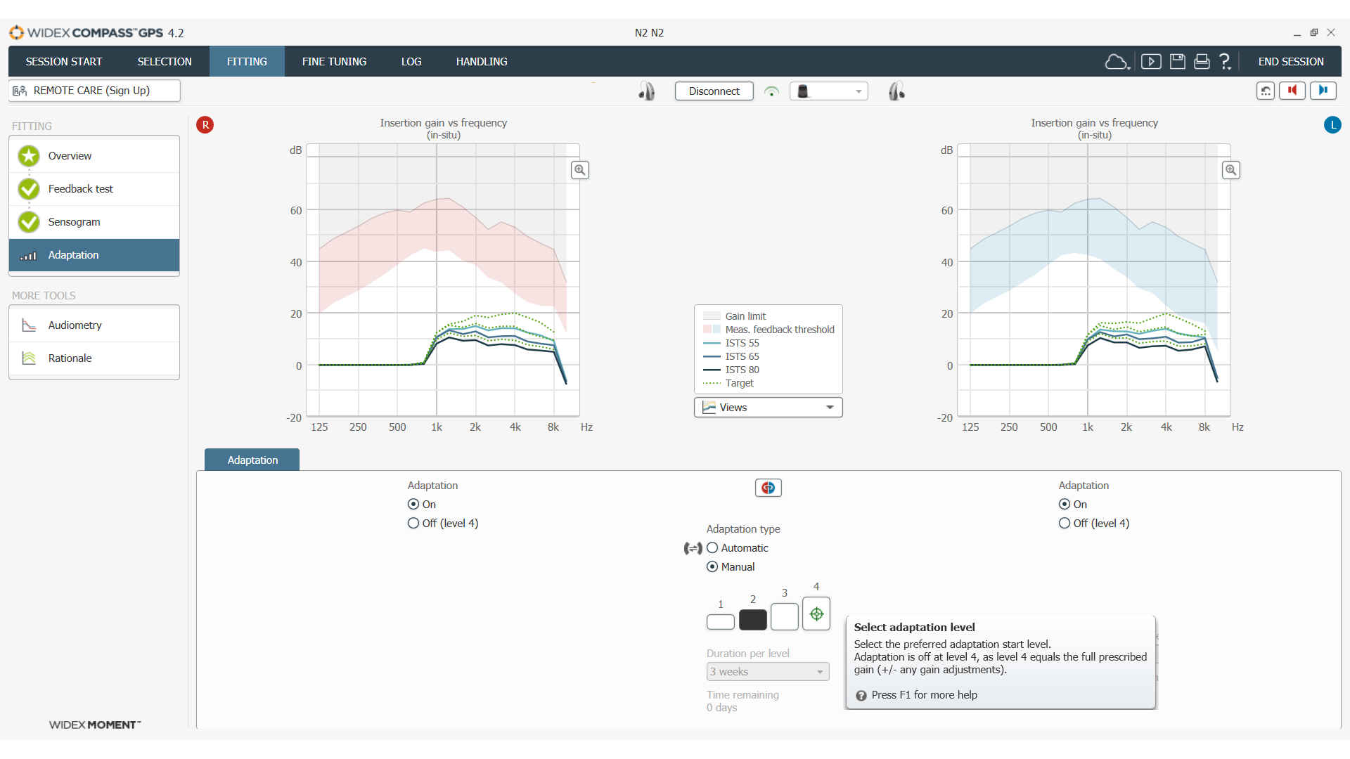 COMPASS fitting software | Widex Pro